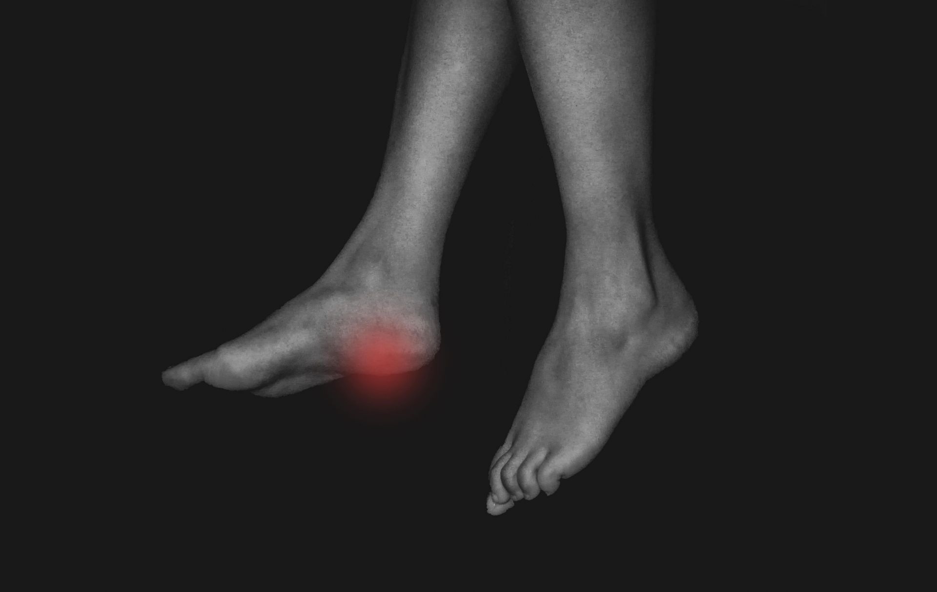 Ik heb pijn aan de hak - wat kan ik doen? | Schutrups