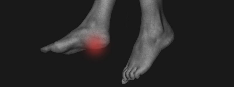 Heb je pijn bij je hiel? Ontdek hier wat je kan doen | Schutrups